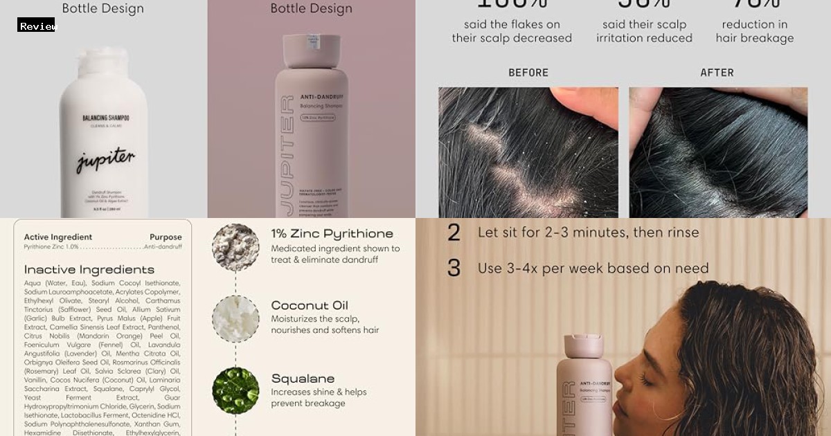 Jupiter Anti Dandruff Shampoo Review: Does it Work? | August 5, 2025